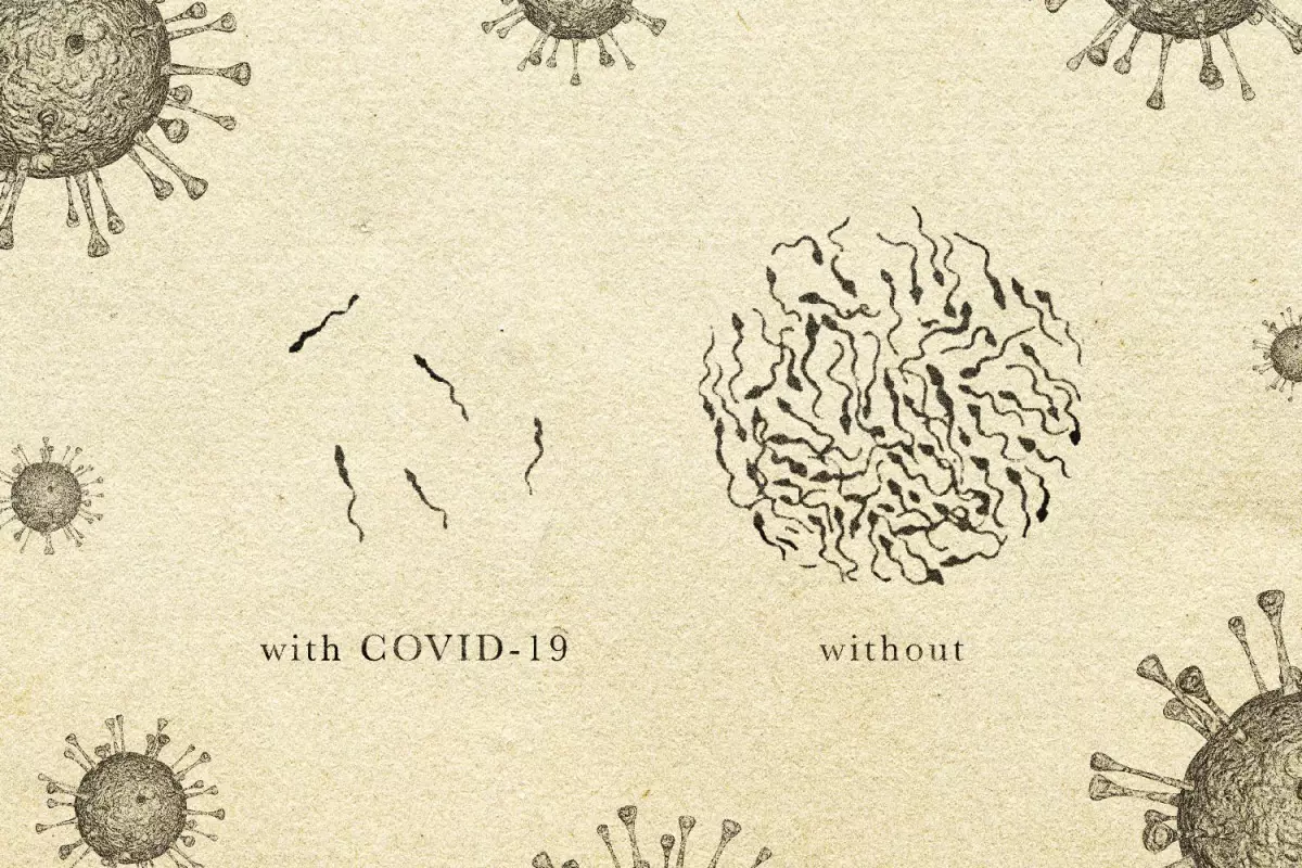 Un diagrama d'espermatozoides sota un microscopi. A l'esquerra: una petita quantitat d'esperma amb l'etiqueta